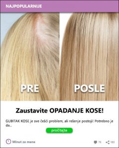 Važno! Gnjide u kosi neće nestati ako ne uradite ovo! | Minut za mene